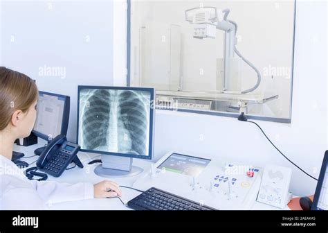 Woman Chest X Ray Hi Res Stock Photography And Images Alamy