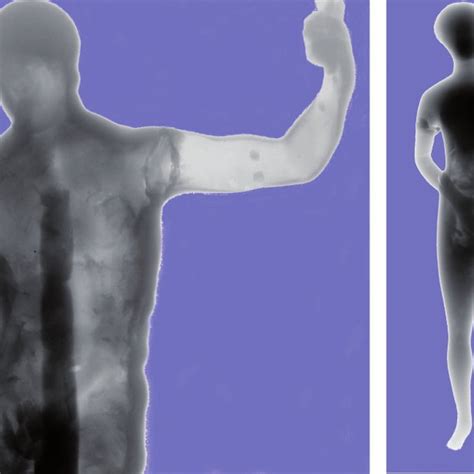 Negative View X Ray Images Showing Thickness Variations Of The Metal Download Scientific