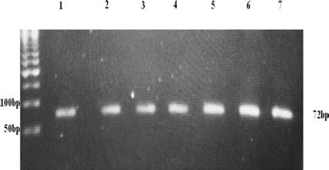 Analysis Of Heterozygous Brca1 5382ins Founder Mutation In A Cohort Of