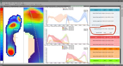 Xsensor® Technology Corporation On Linkedin Intelligentinsoles Plantarpressure