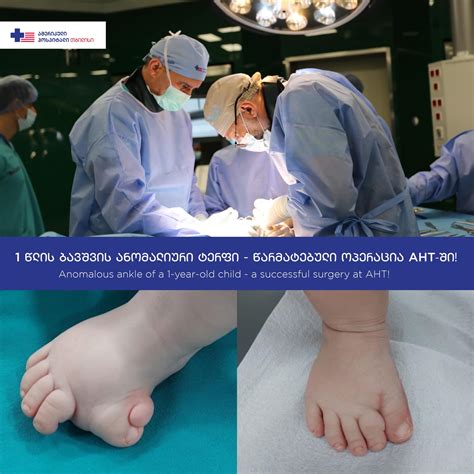 American Hospital Tbilisi „ამერიკულ ჰოსპიტალ თბილისში“ პაციენტს მარჯვენა ტერფის ანომალიის