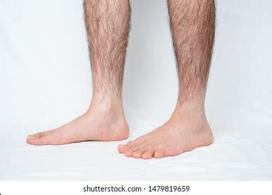 Legs Hair Removal Men Before Stock Photo Shutterstock