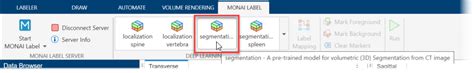 Segment Ct Scan Using Monai Label Matlab And Simulink