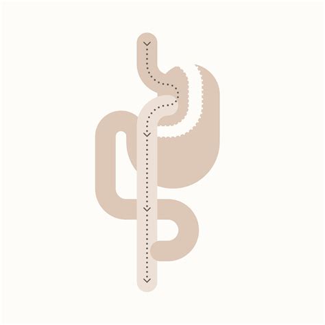 Gastric Bypass Surgery Dr George Balalis