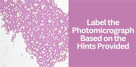Comprehensive Guide To Label The Photomicrograph Based On The Hints Provided My Blog