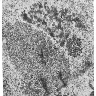 Electron Micrograph Of The Sex Pair At Late Pachytene The Sex Vesicle
