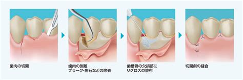 六本松｜歯周病専門医がいる福岡市中央区の歯医者 六本松矯正歯科と歯医者 子供から大人まで対応する歯科医院
