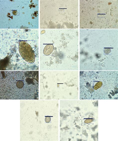 Figure 1 From Parasitic Egg Detection With A Deep Learning Ensemble Semantic Scholar