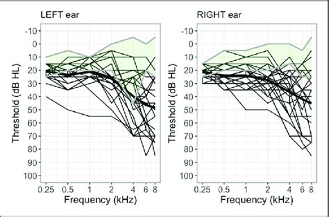 Audiogram Results For The Left And Right Ears Note The Bold Black Download Scientific Diagram