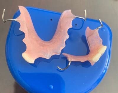 Custom Missing Teeth Flipper Stayplate For Upper Lower Hard Acrylic