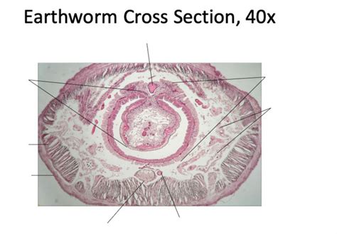 Solved Fill In The Blank Earthworm Cross Section 40x