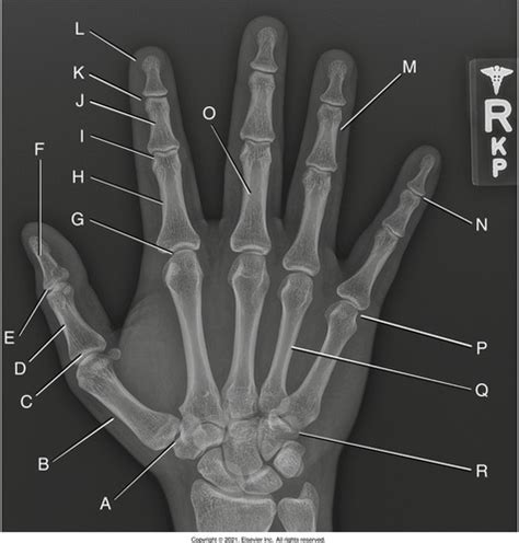 Upper Limb Anatomy Flashcards Quizlet