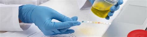 Urinary Ethyl Glucuronide Etg And Ethyl Sulphate Ets Assessment