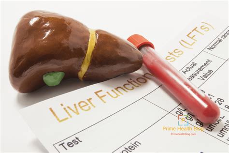 Liver Enzyme Tests Levels Of Ast Sgot And Alt Sgpt