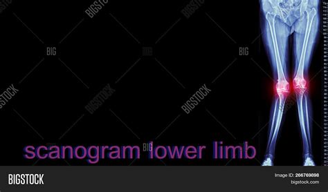 Scanogram X Ray Image Image And Photo Free Trial Bigstock