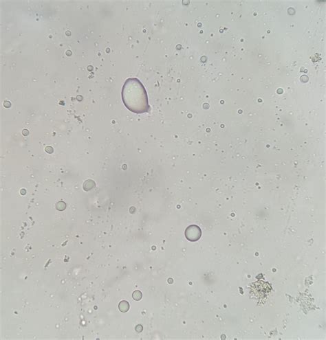 Help Me Identify The Microbes R Microscopy