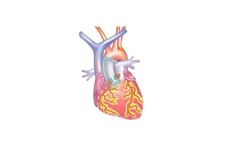 მთავარი • Open Heart