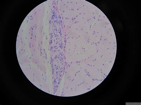 Esophagus Pptx د منال الفصل الثاني Muhadharaty