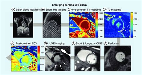 An Emerging Cardiac Mri Workflow Designed For High Quality Structural Download Scientific
