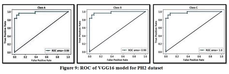 A Deep Learning Based Transfer Learning Framework For The Early Detection And Classification Of