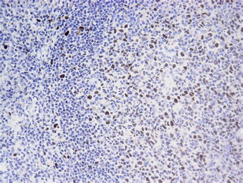 Eed Antibody Clone 41d Chip Seq Ihc Ffpe