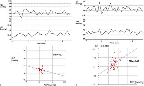 Prx Index Calculated As Linear Correlation Coefficient Between Download Scientific Diagram