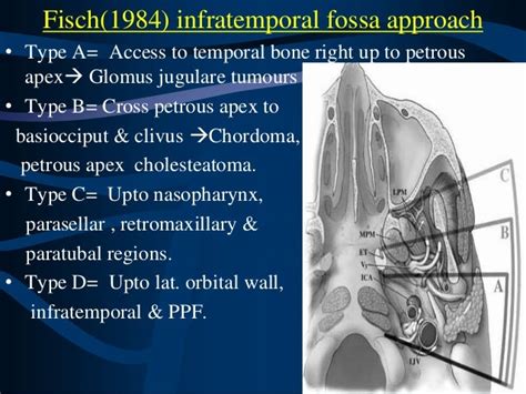 Surgical Anatomy Of Infratemporal Fossa By Dr Aditya Tiwari
