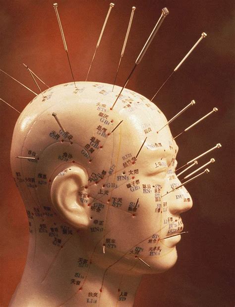 中医针灸的渊源 发展