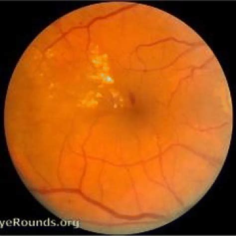 Supervised And Unsupervised Learning Framework Using Ml And Dl 8 27