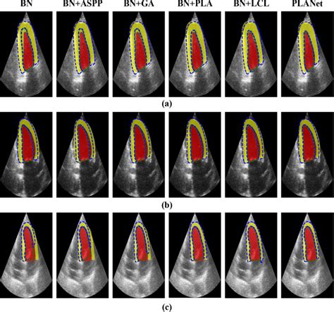 Qualitative Comparison Between The Annotations And Segmentation Results Download Scientific