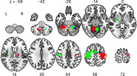 Human Sensorimotor Cortex Reactivates Recent Visuomotor Experience During Awake Rest Eneuro