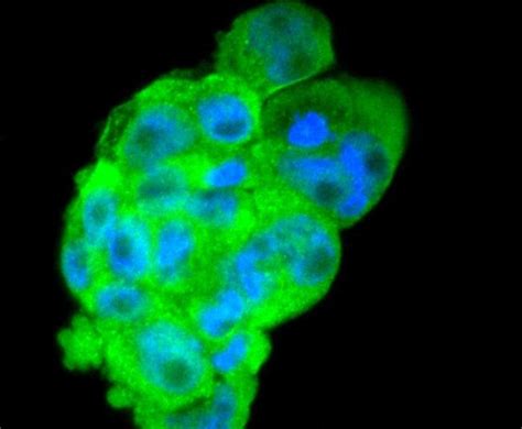 Dkk1 Recombinant Rabbit Monoclonal Antibody Sc06 86 Invitrogen 100