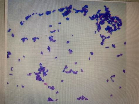 Solved Staphylococcus Saprophyticus What Is The Shape And