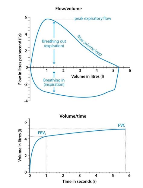 Spirometry Curve At Ronnie Anderson Blog