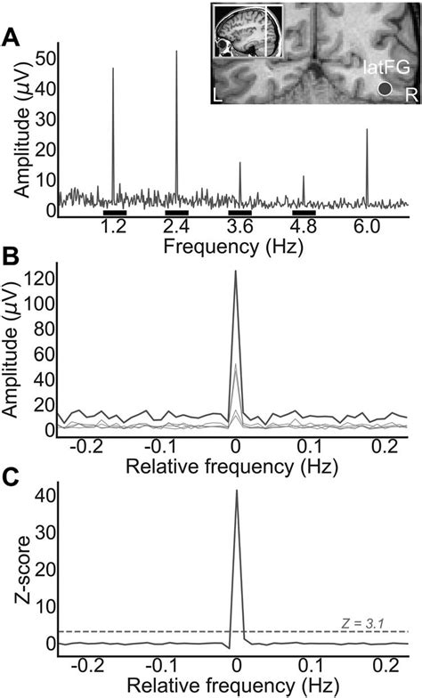 Intracerebral Selective Responses Recorded In The Votc A Download Scientific Diagram