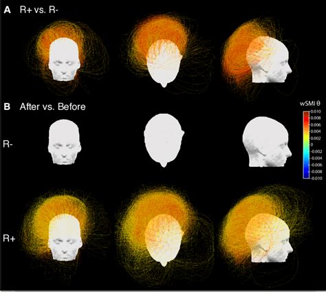 Functional Connectivity In The Theta Alpha Band Download Scientific Diagram