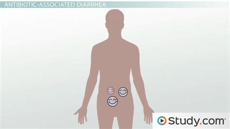 Opportunistic Infections Definition Types And Examples Lesson