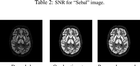 Figure 3 From Hybrid Regularization For Data Restoration In The Presence Of Poisson Noise