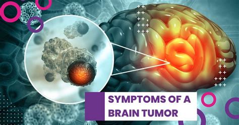 What Are The Symptoms Of A Brain Tumor And When Should We Seek Medical Attention Sri