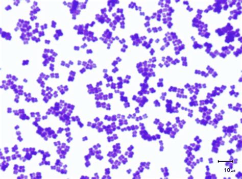 Micro Exam 2 Flashcards Easy Notecards