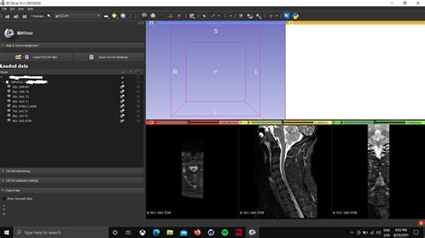 Failing Loading Scalar Volume Warning It Was Given As Seen At The