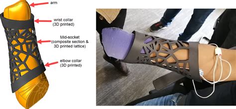 Construction Of The 3d Printed Socket Structure Download Scientific