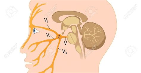 Nervios Craneales Nervio Trigemino