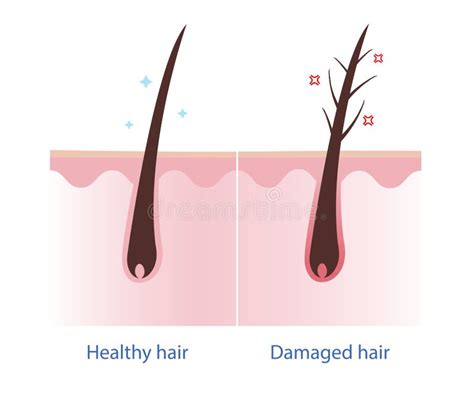 Damaged Frizzy Hair Treatment Repair Stock Illustrations 26 Damaged