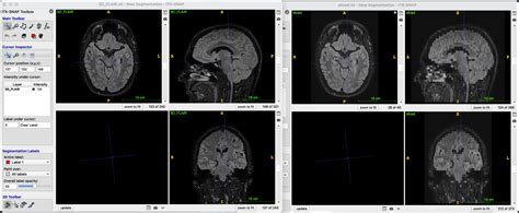 Resampling To New Voxel · Issue 396 · Antsx Antspy · Github