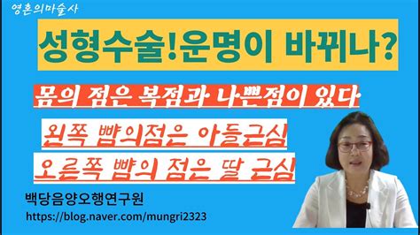 성형수술 운명이바뀌나 귀의점은 복점 Youtube