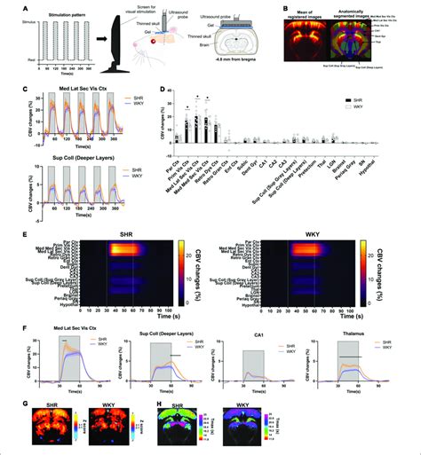 Functional Ultrasound Imaging Fus Responses To Visual Stimulation Download Scientific