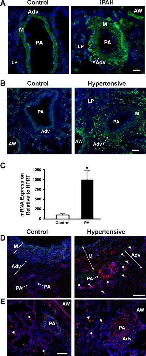 Figure 1 From Osteopontin Is An Endogenous Modulator Of The