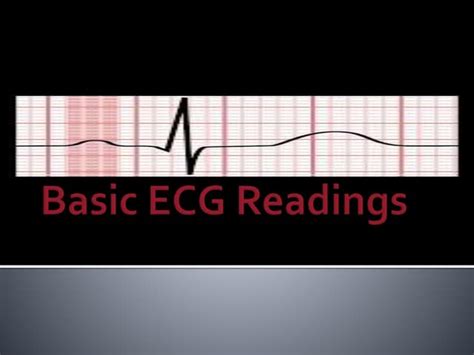 Basic Ecg Readings Pptx
