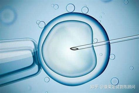 做试管婴儿的五大优点你都知道吗 知乎